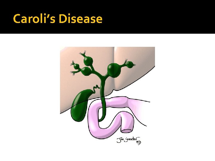 Holdorf Abdominal Sonography Part 1 The Biliary Tract