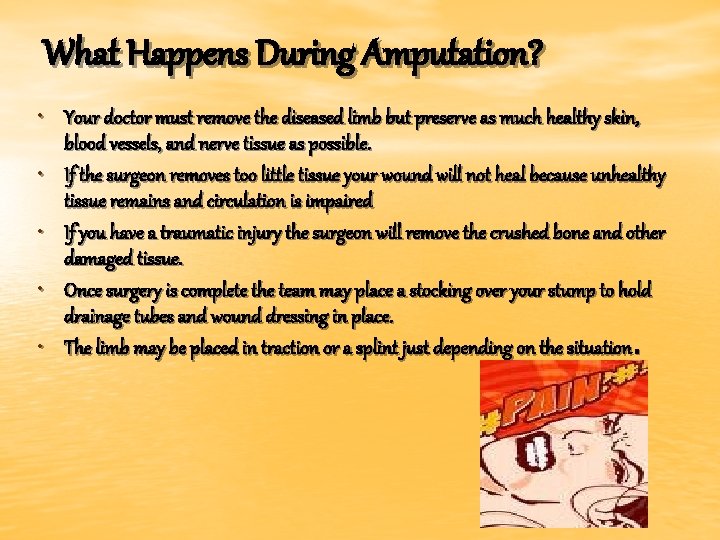 AMPUTATION Presented By Marieann Mc Ghee Pathophysiology The