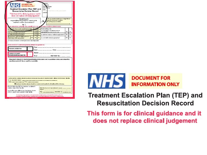 Treatment Escalation Plan TEP and Resuscitation Decision Record