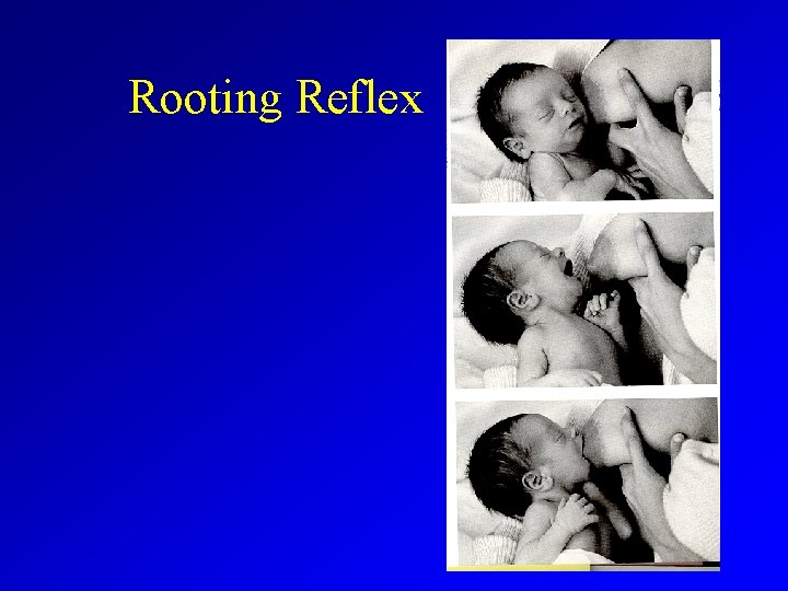 Triggers for Labor Oxytocinpitocin Breaking of Amniotic Sac