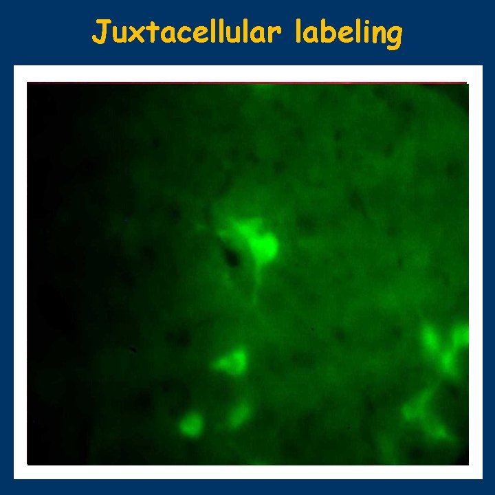 Special role of basal forebrain BF Double role