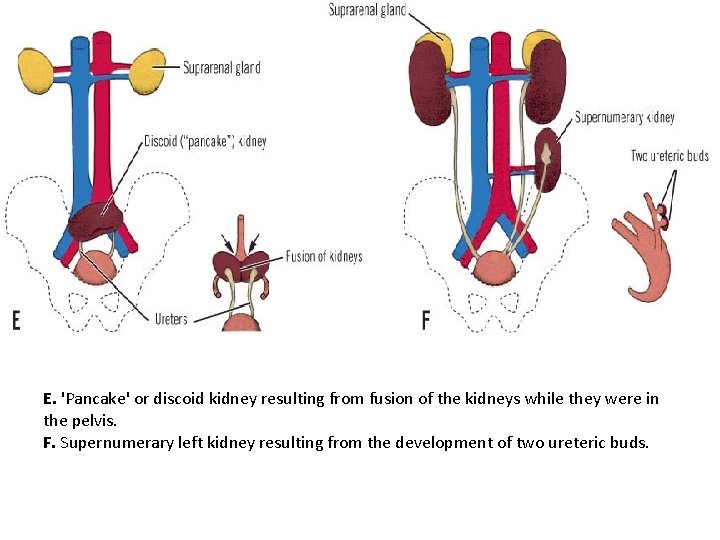 Embryogenesis of the Kidneys and Ureters Normal Development