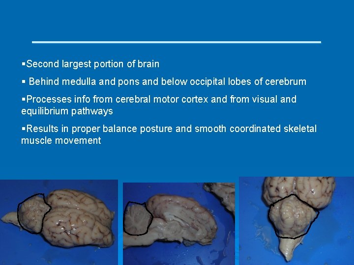 BA BA BA Sheep Brain Dissection By Katelyn