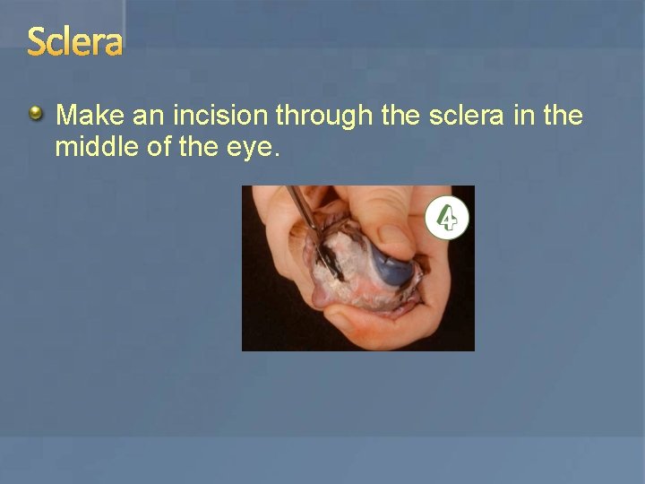 Eye Enucleation VETT 2 L Anatomy Lab Preparation