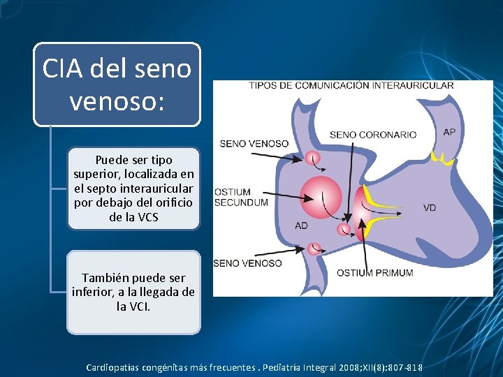 Comunicacin InterAuricular Nios Andrea Lilin Velzquez Glodias Tabicacin