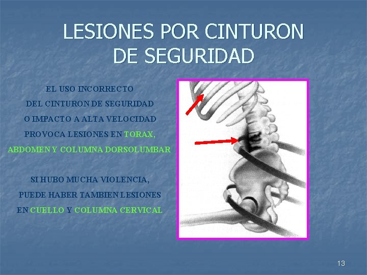 CINEMATICA MECANISMOS LESIONALES DEL TRAUMA 1 OBJETIVOS COMPRENDER