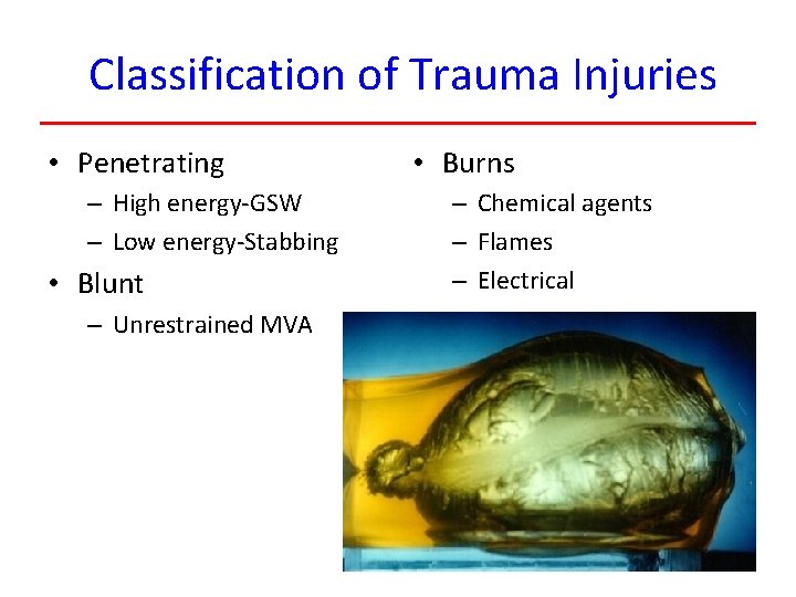 Anesthesia Care for the Trauma Patient LTC ret