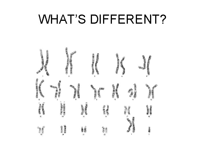 Karyotypes A picture of a persons chromosomes Karyotype