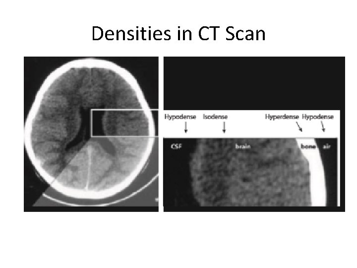 Basics of CT brain Dr Aminur Rahman FCPS
