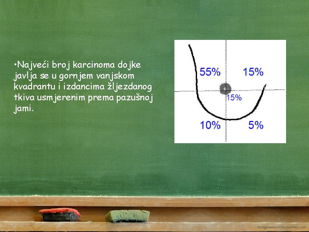 RAK DOJKE to je tumor dojke Tumor dojke