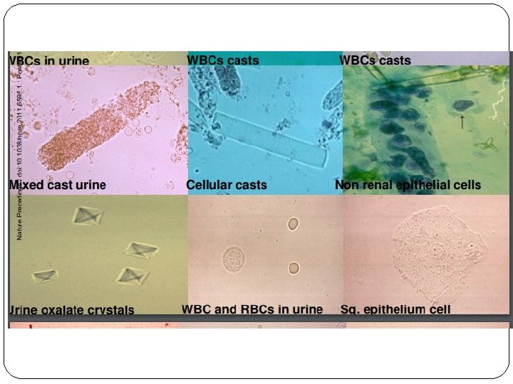 URINE AND ITS COMPONENTS PRESENTATION FROM DEW DIAGNOSTIC