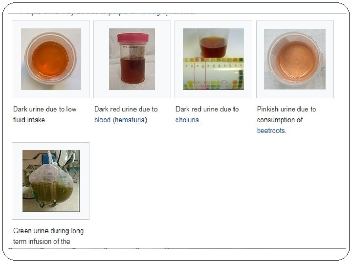 URINE AND ITS COMPONENTS PRESENTATION FROM DEW DIAGNOSTIC