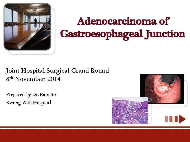 Adenocarcinoma of Gastroesophageal Junction Joint Hospital Surgical Grand