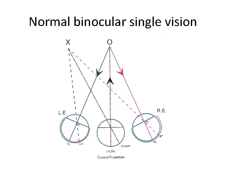 Projection in Heterotropia Helen Griffiths Year 1 October