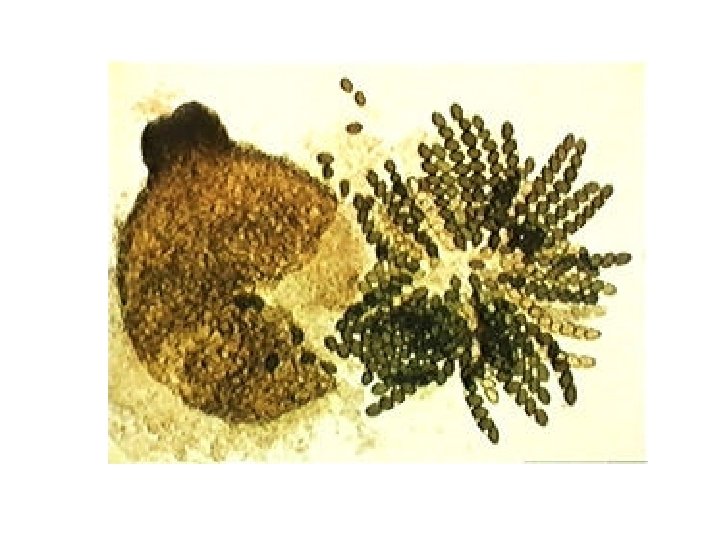 Sordaria Meiosis Lab Sample of Sordaria in petri