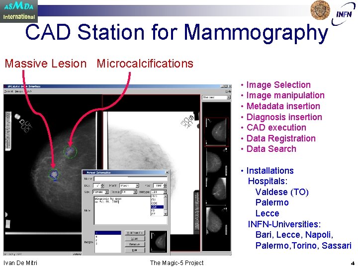Implementing Computer Assisted Detectionn systems for the analysis