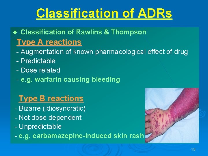 Pharmacovigilance Adverse Drug Reactions Dr Mohammed AlSbou MD