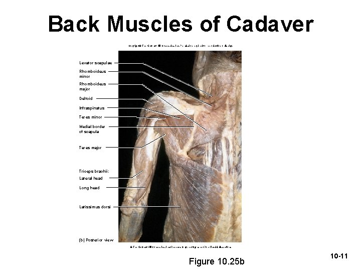 Muscles acting on the shoulder and upper limb