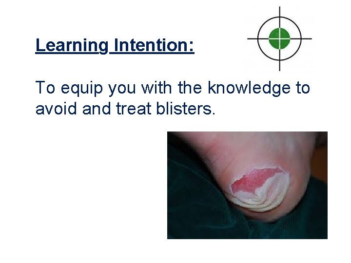 Skill Section Wilderness First Aid Skill 617 Blisters