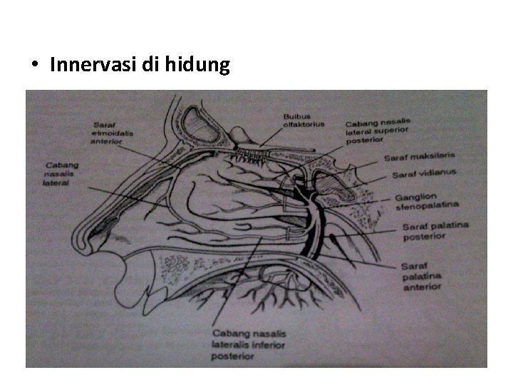 REFERAT ABSES SEPTUM NASI Oleh Muh Hasan S