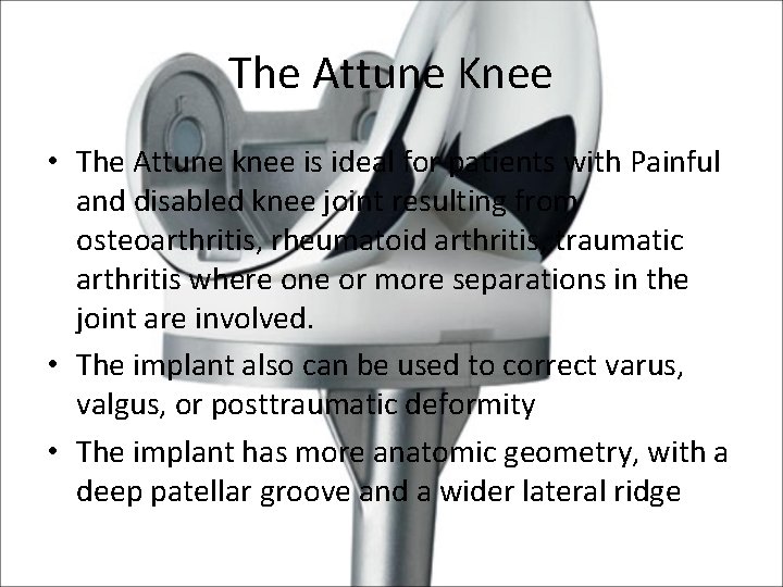 Knee Replacement Options The Attune Knee By Brian