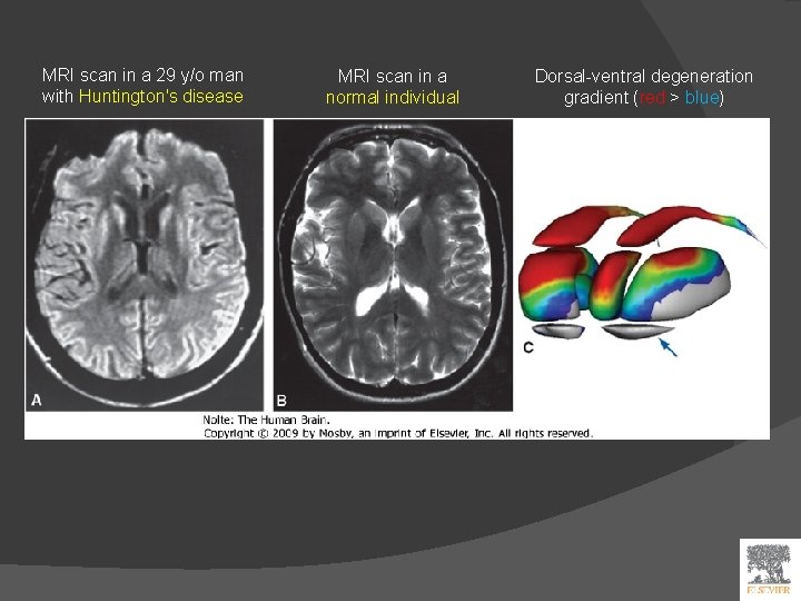 Basal Ganglia Principles of neural sciences 5 th