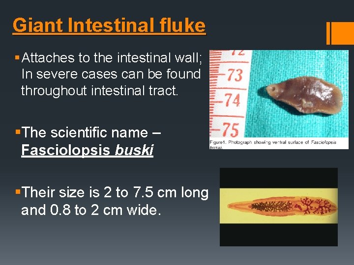 Parasites Giant Intestinal Fluke Chinese Liver Fluke Sheep