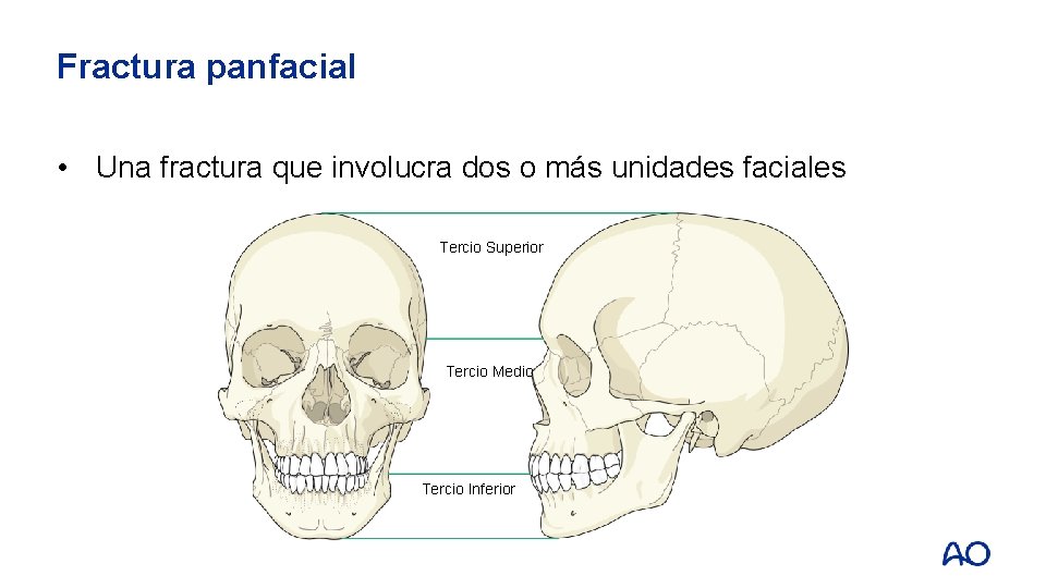 Fracturas Panfaciales Secuenciacin de la Reparacin Presenters name