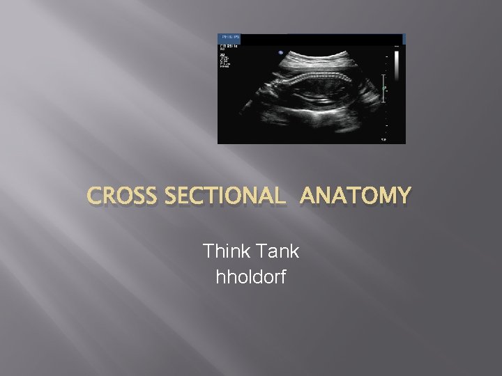 CROSS SECTIONAL ANATOMY Think Tank hholdorf 1 The