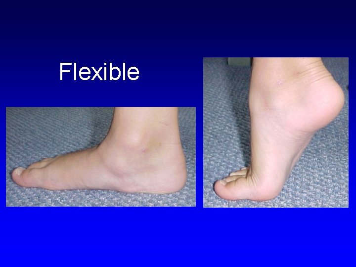 Normal and abnormal in Paediatric Orthopaedics what should