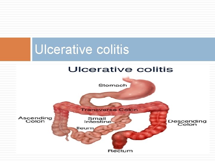 INFLAMMATORY BOWEL DISEASE Describe the different types of