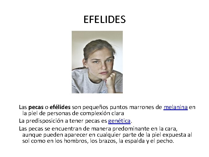 MACULAS Cambio de coloracin en la piel sin