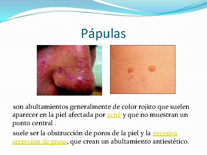 MACULAS Cambio de coloracin en la piel sin