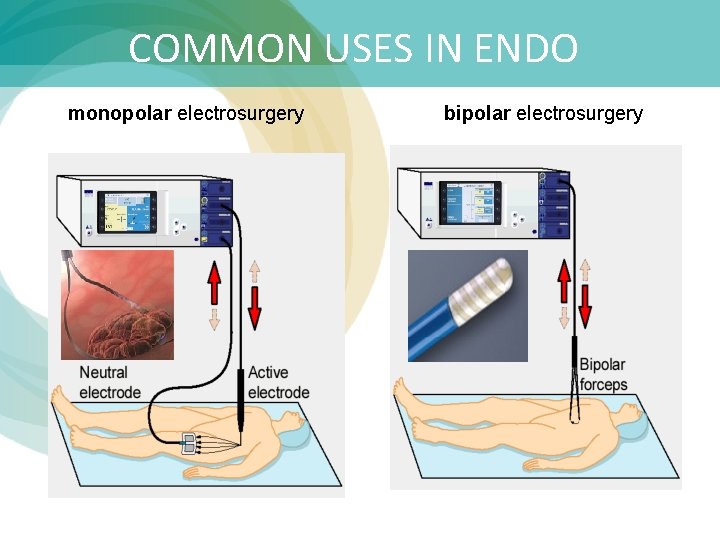 ELECTROSURGERY IN ENDOSCOPY THE FACTS ABOUT ELECTRICTY 1