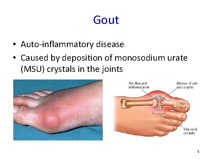 The role of p 110 class I PI
