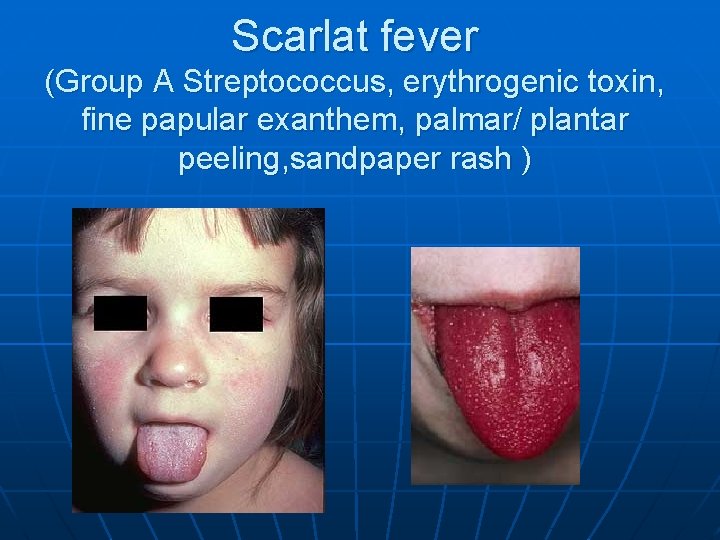 common Pediatric diseases Prepared by Dr Latifa Marie