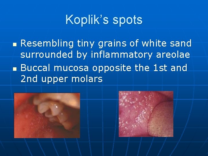 common Pediatric diseases Prepared by Dr Latifa Marie
