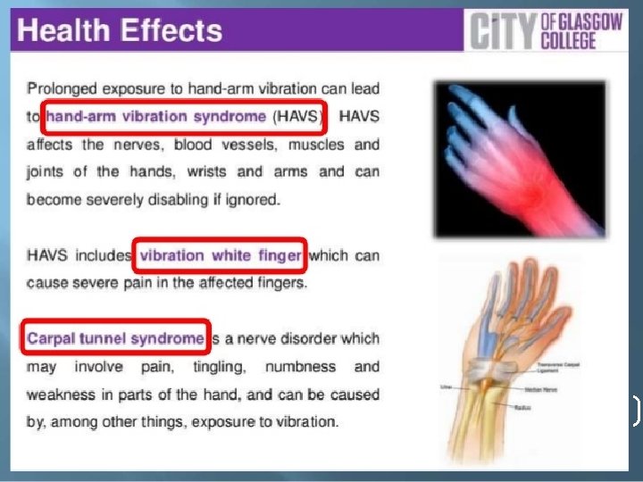 Disorders Related To Vibration Exposure 1 Vibration occurs