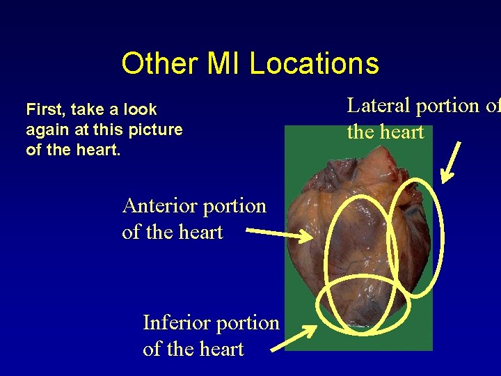 ECG Rhythm Interpretation Module V Acute Myocardial Infarction