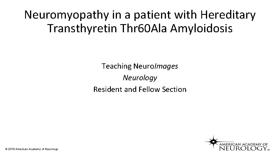 Neuromyopathy in a patient with Hereditary Transthyretin Thr