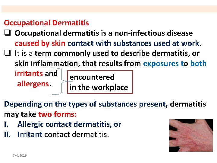 Prof DR Waqar Al Kubaisy 742019 OCCUPATIONAL DERMATITIS