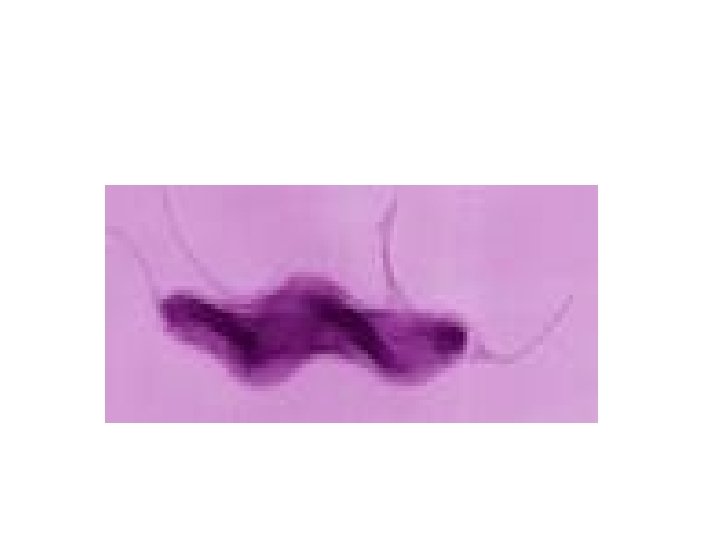 CAMPYLOBACTERIOSIS ANTES VIBRIOSIS ETIOLOGA Campylobacter fetus Bacteria G