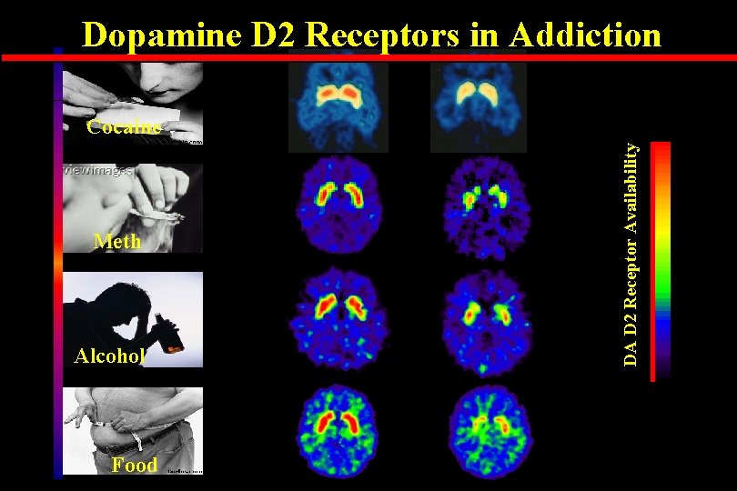 DRUG ABUSE MENTAL ILLNESS Progress in Understanding COMORBIDITY