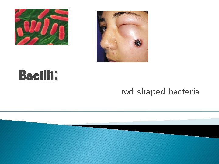 Science Test Review Disease Mrs Connnor Antibiotics A