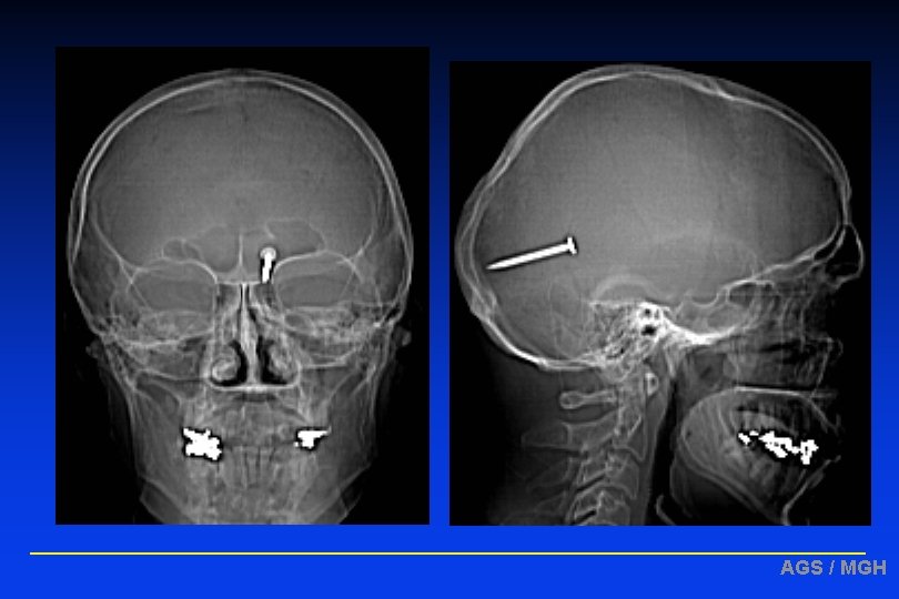 Human Subjects in f MRI Research Credits Robert