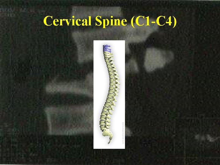 NEUROLOGY Spinal Cord Injuries Spinal Cord The etiology