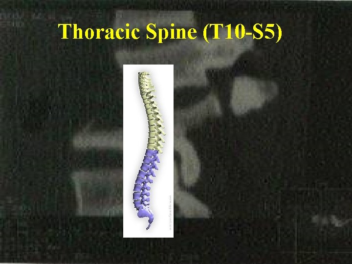 NEUROLOGY Spinal Cord Injuries Spinal Cord The etiology