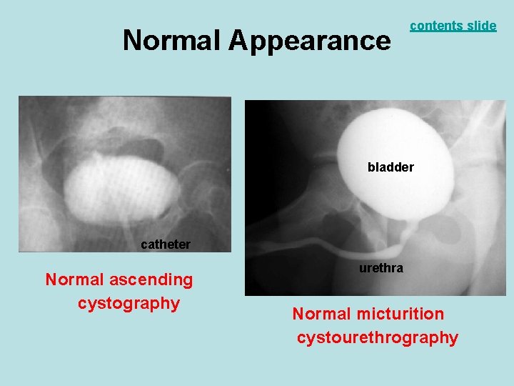 Surgical Radiology Urology Department of General Surgery Cairo