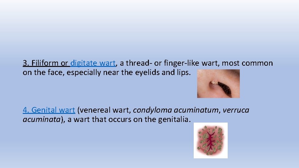 Common viral Infections Prof Khitam AlRefu Common Cutaneous