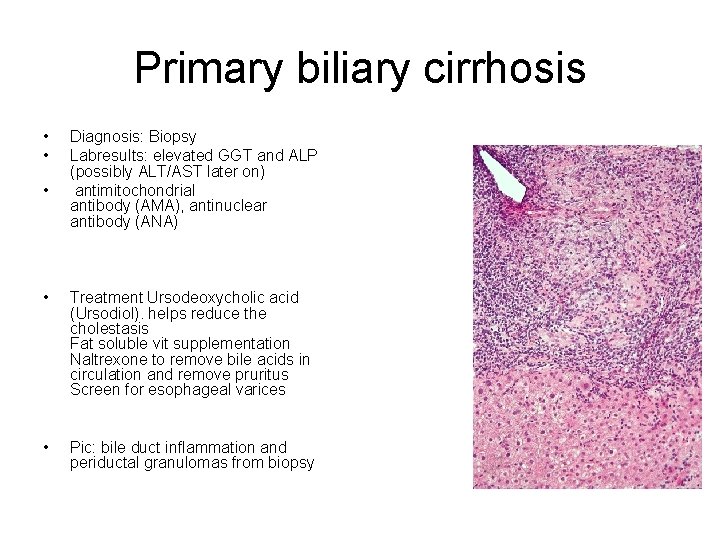 Cholestasis Emil Hizbullah and Martin Definition Cholestasis is